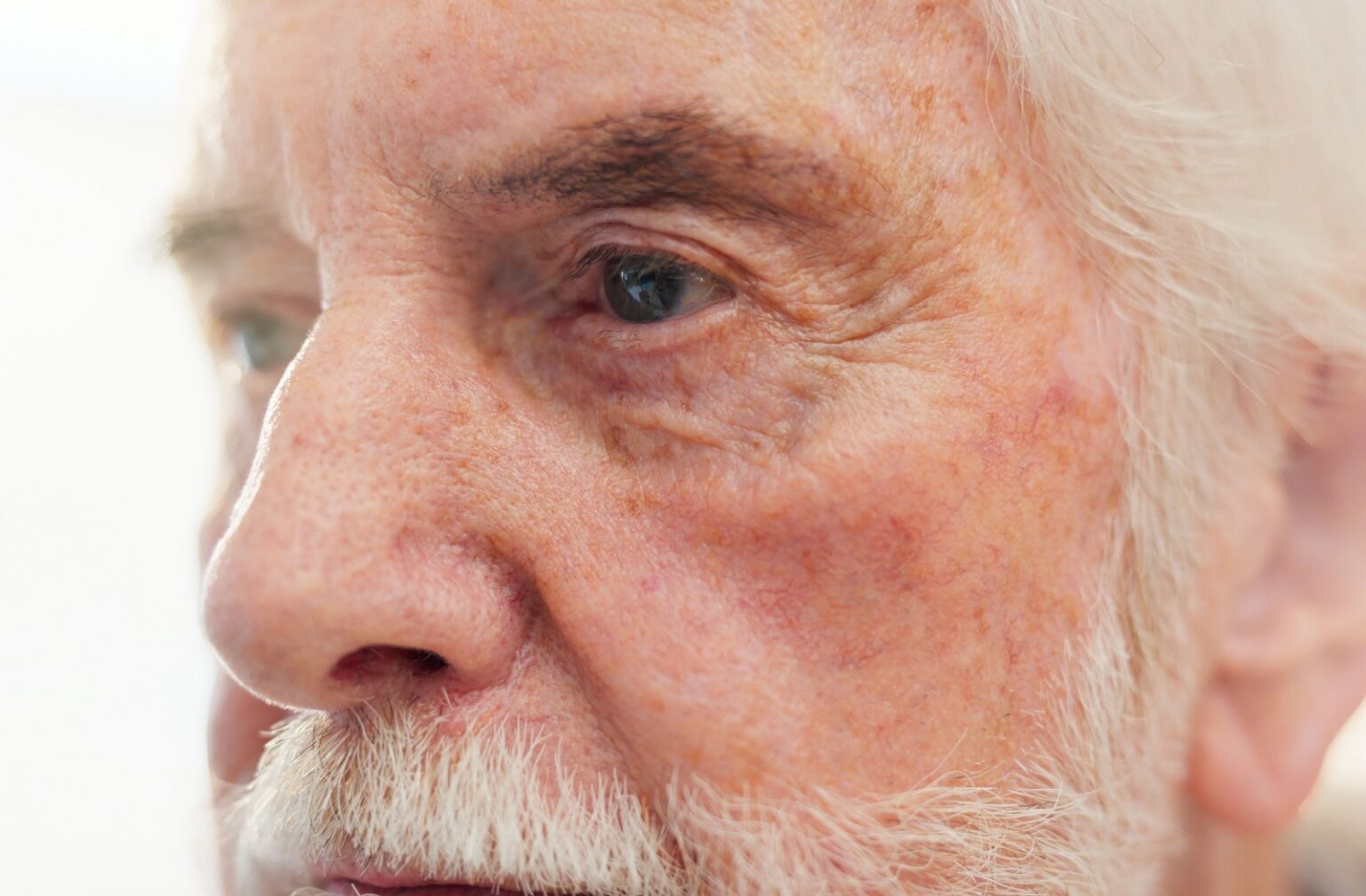 Optimizing the Dry AMD Treatment Journey From Diagnosis to Management